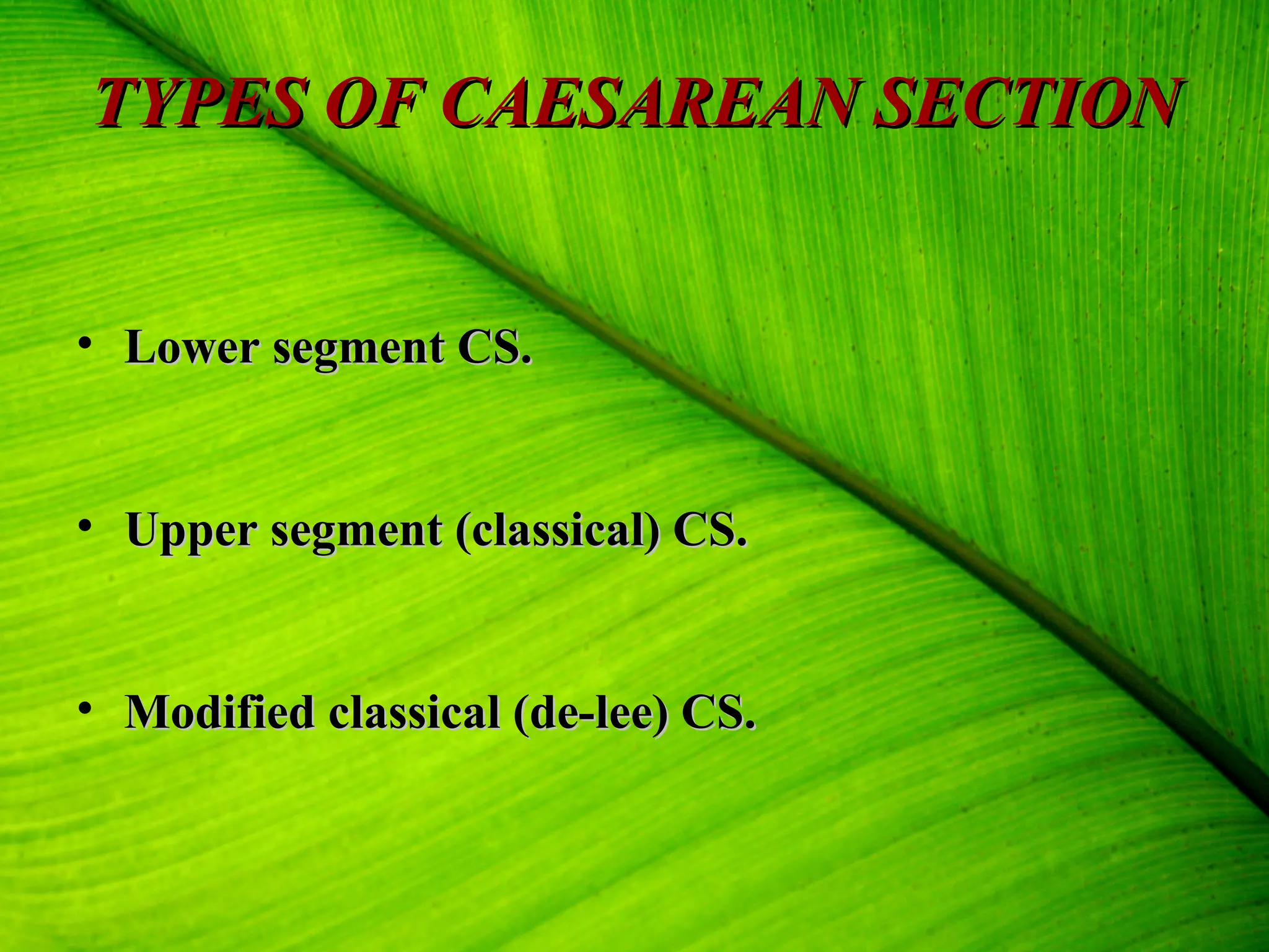 Caesarean section | PPT