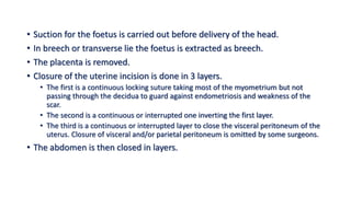 Caesarean section | PPT