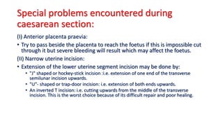Caesarean section | PPT