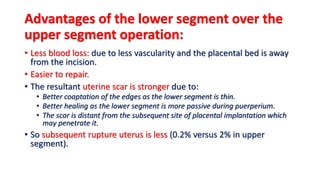 Caesarean section | PPT