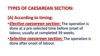 Caesarean section | PPT