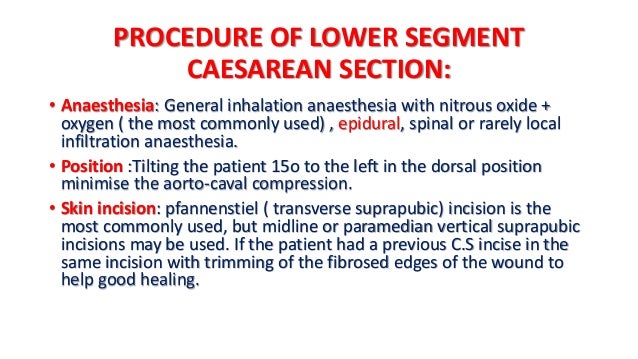 Caesarean section