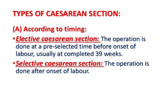 Caesarean Section
