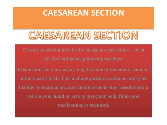 Caesarean section | PPT