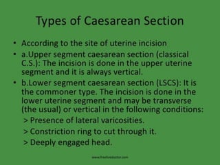 Caesarean section | PPT