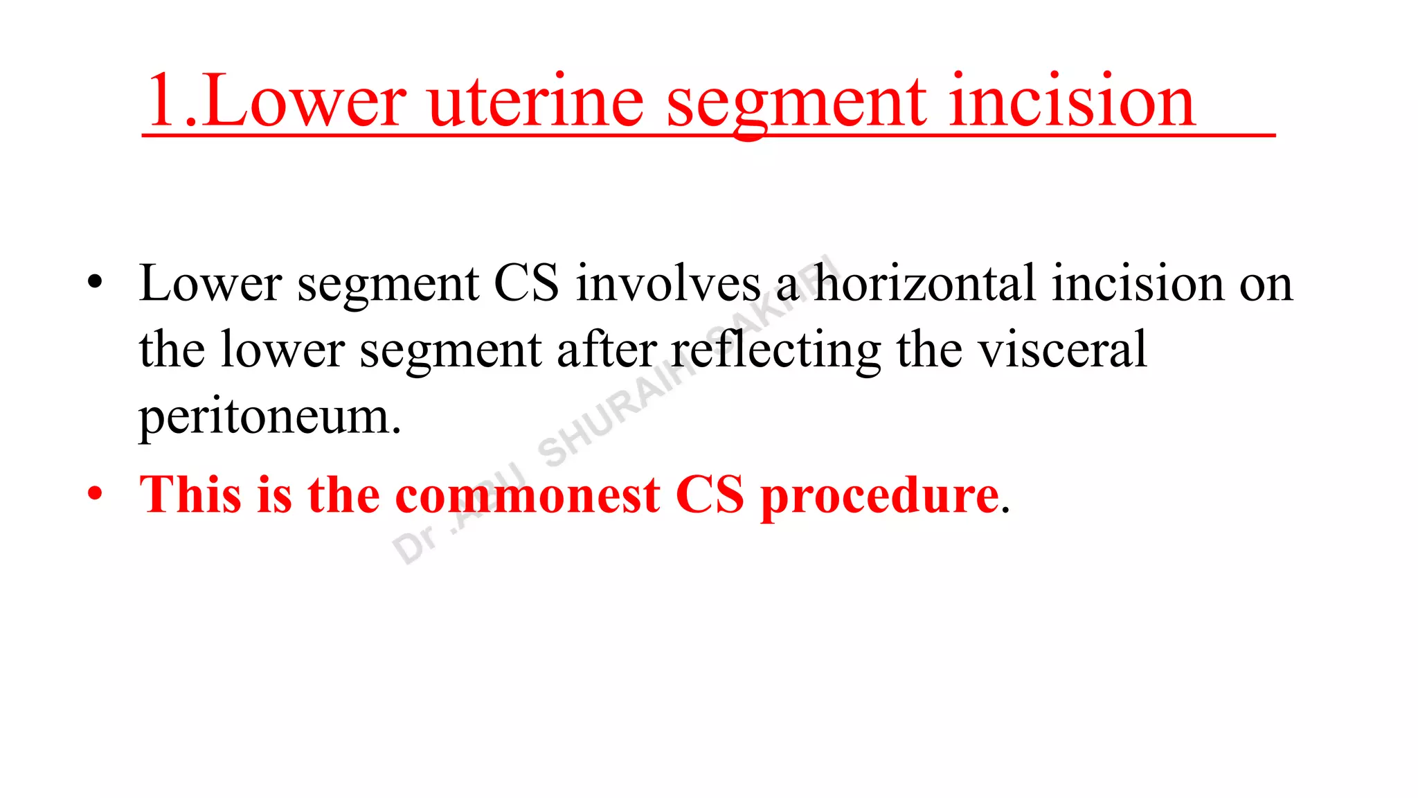 Caesarean section | PPTX