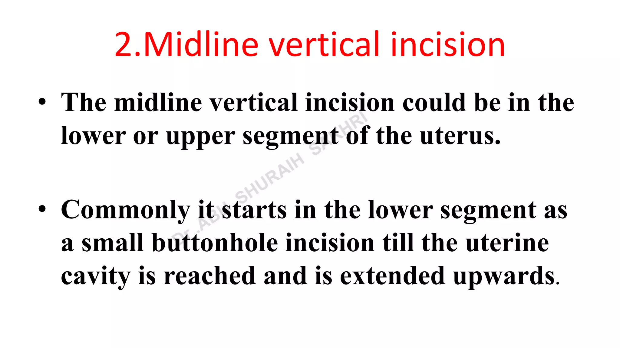Caesarean section | PPTX