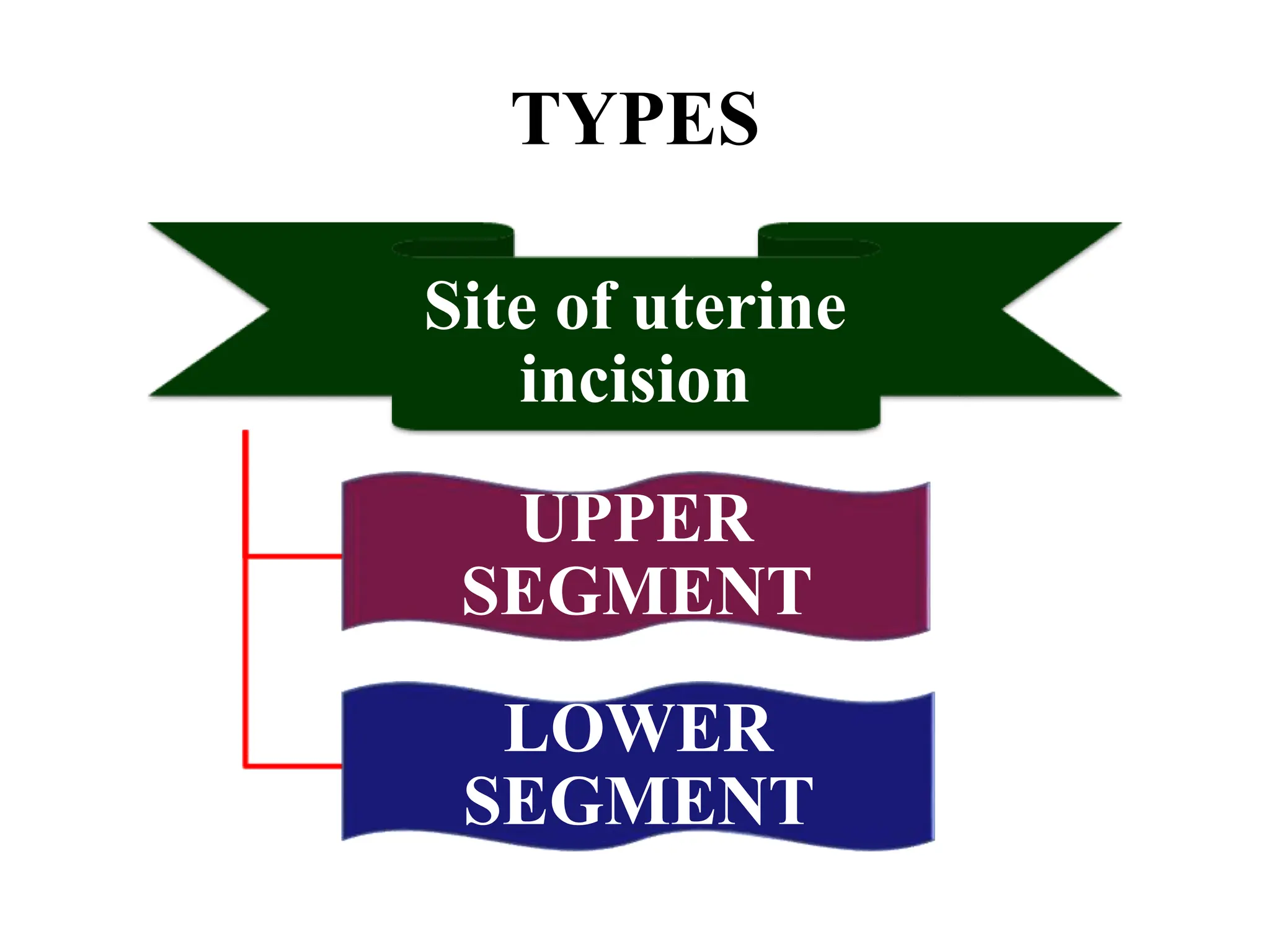 caesarean section.pptx for nursing students | PPTX
