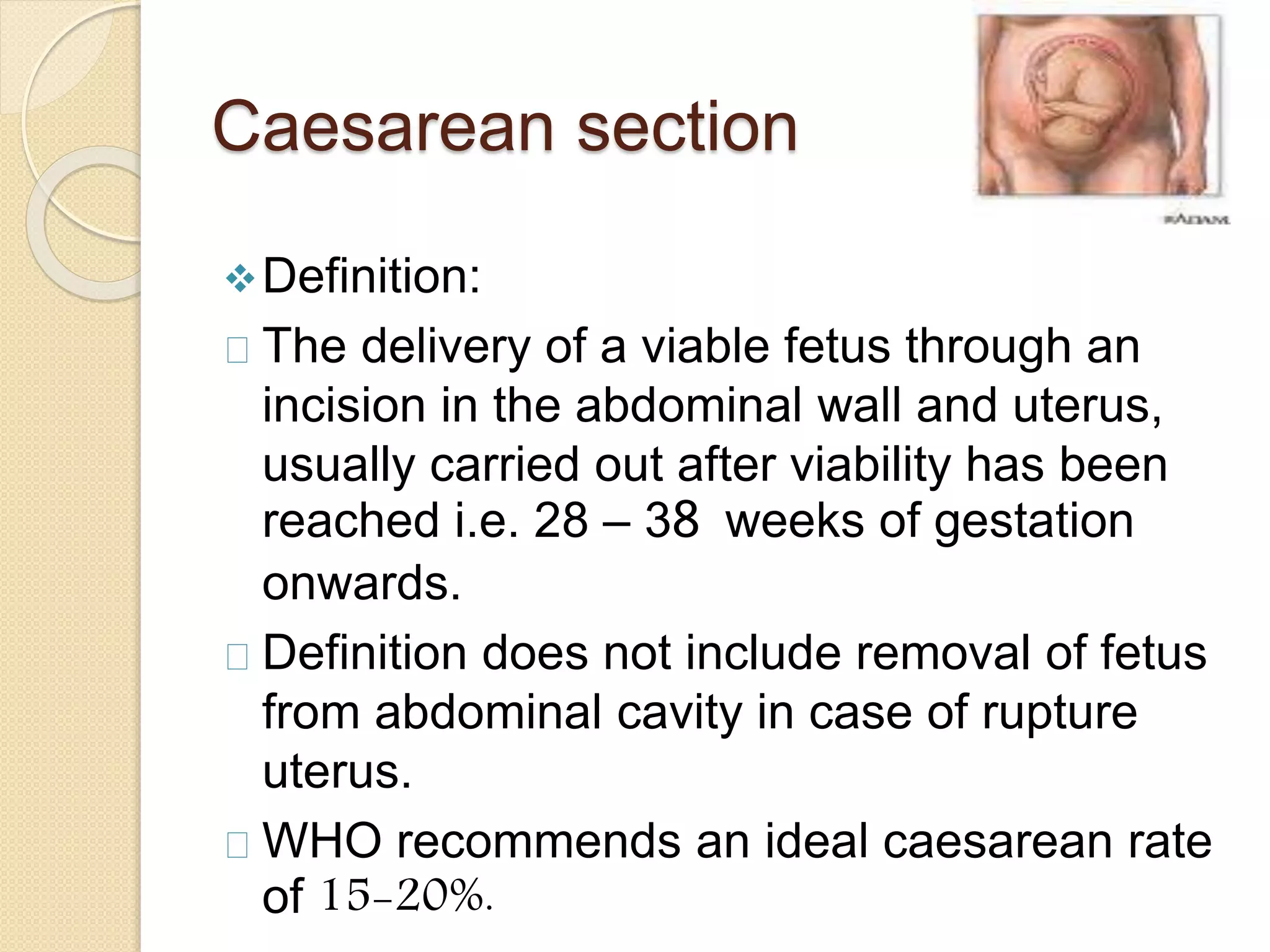 Caesareansection Best Pptx