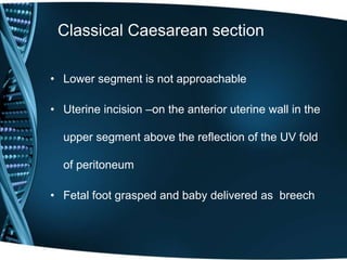 Caesarean section - indications and types | PPTX