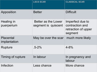 Caesarean section - indications and types | PPTX