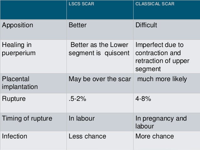 Caesarean Section Indications And Types