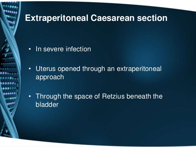 Caesarean section - indications and types