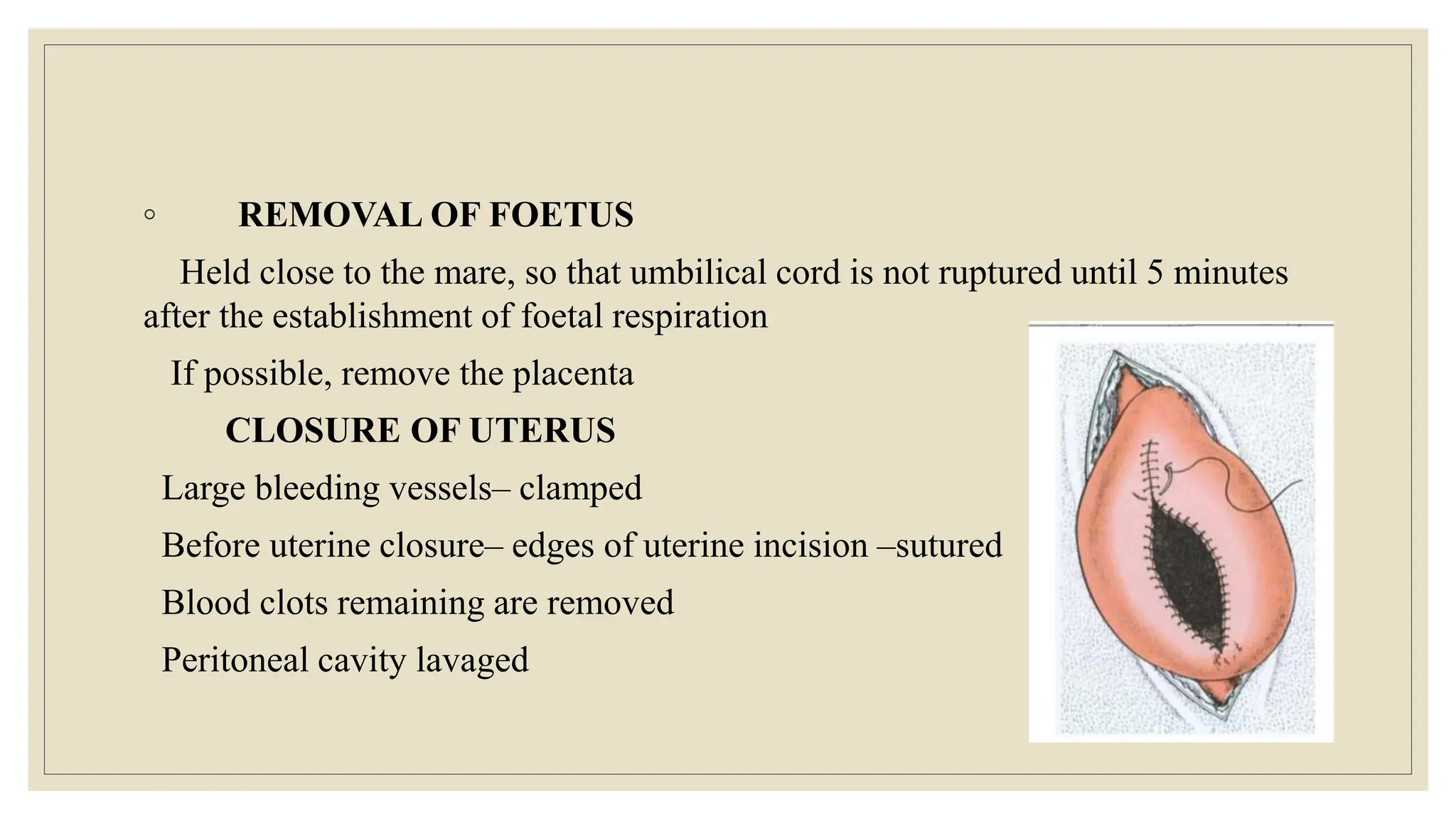 CAESAREAN SECTION AND OVARIOHYSTERECTOMY PPT.pptx