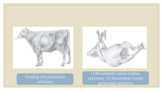 CAESAREAN SECTION AND OVARIOHYSTERECTOMY PPT.pptx