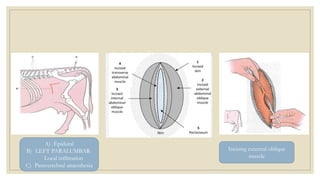 CAESAREAN SECTION AND OVARIOHYSTERECTOMY PPT.pptx