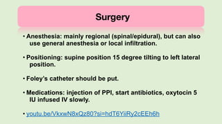 Caesarean Section (C/S).pdf