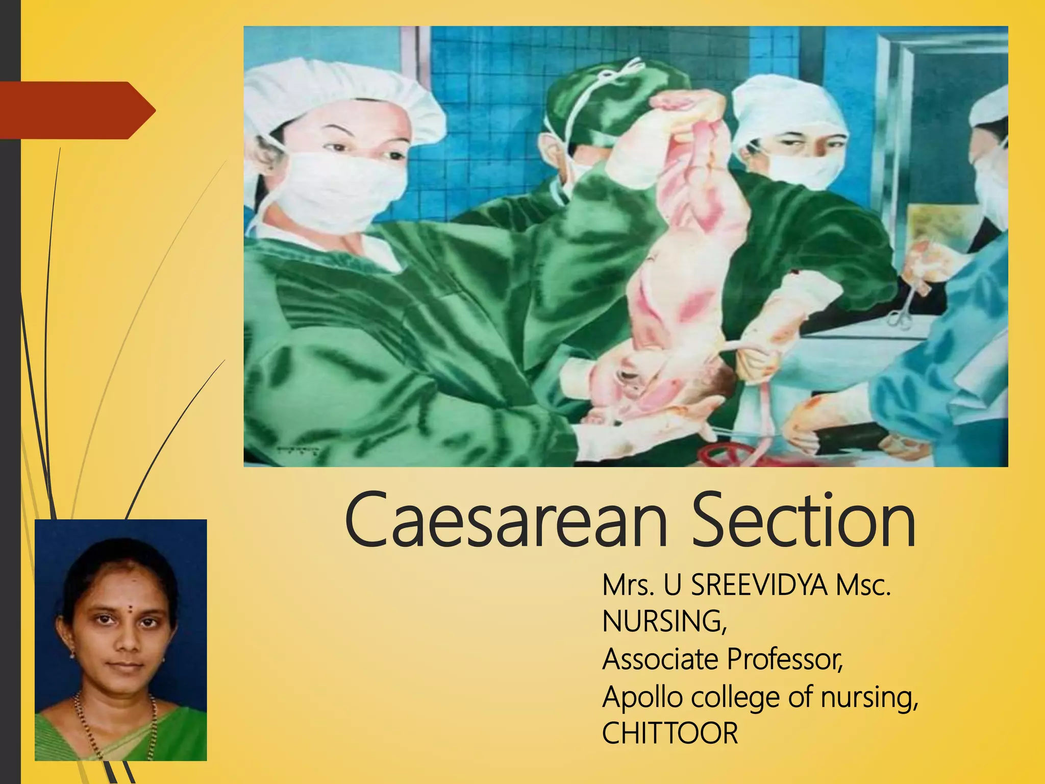 Caesarean section & others | PPTX