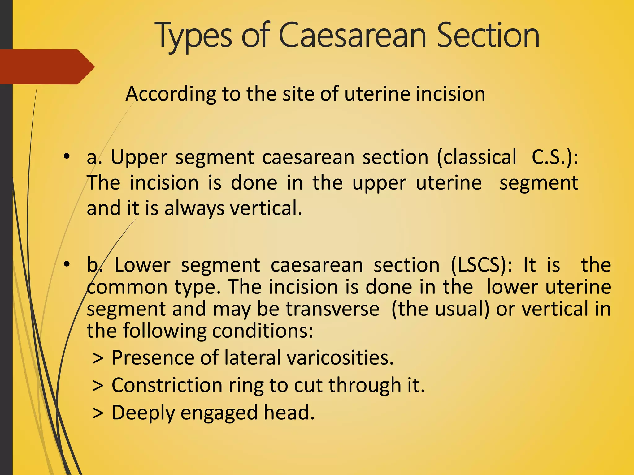 Caesarean section & others | PPTX