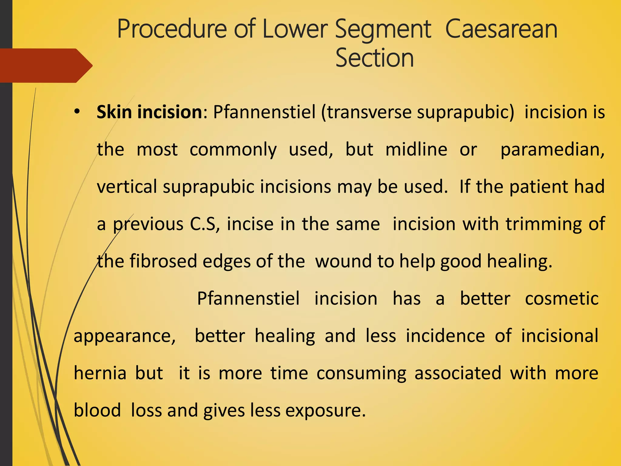 Caesarean section & others | PPTX