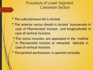 Caesarean section & others | PPTX
