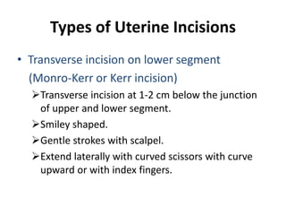 Caesarean section (techniques) pgp | PPT