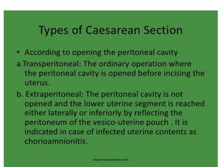 Caesarian section | PPT