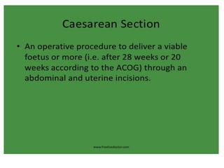 Caesarian section | PPTX