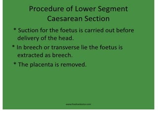 Caesarian section | PPT