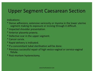 Caesarian section | PPT