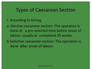 Caesarian section | PPTX