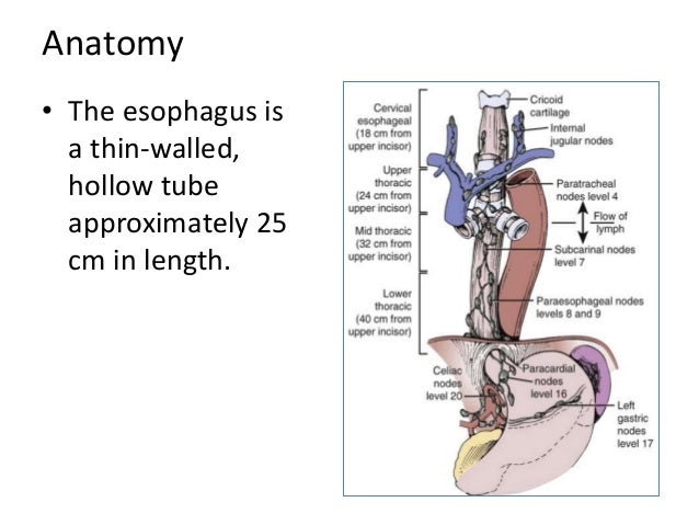 Ca esophagus