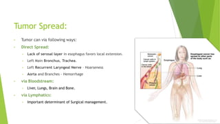 Carcinoma Esophagus | PPTX