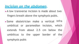 caessariansection-220221143945.pptx