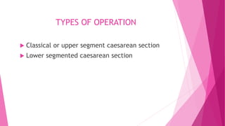 Caesarean section | PPTX | Pregnancy | Reproductive Health