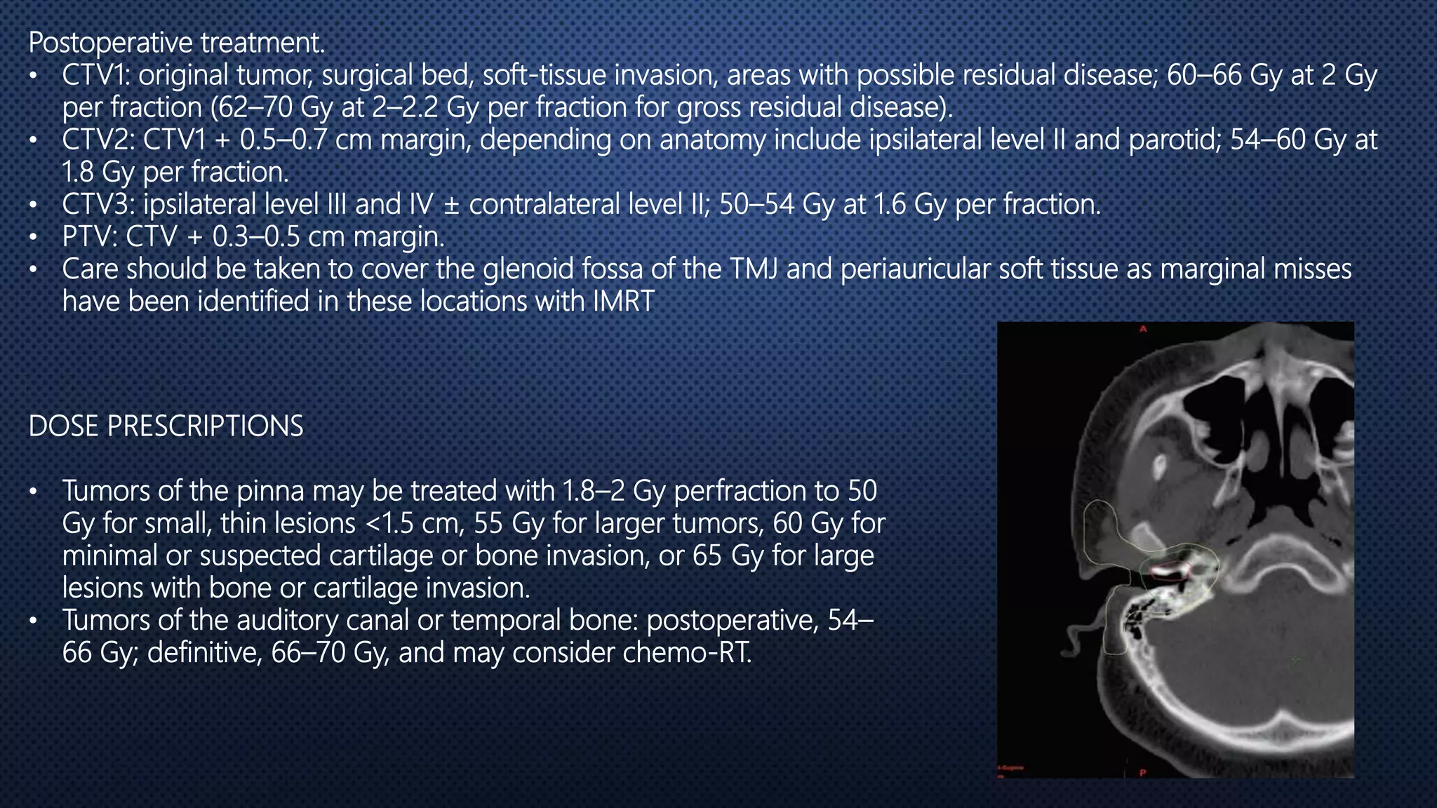 Ca external and middle ear staging to management1 | PPTX