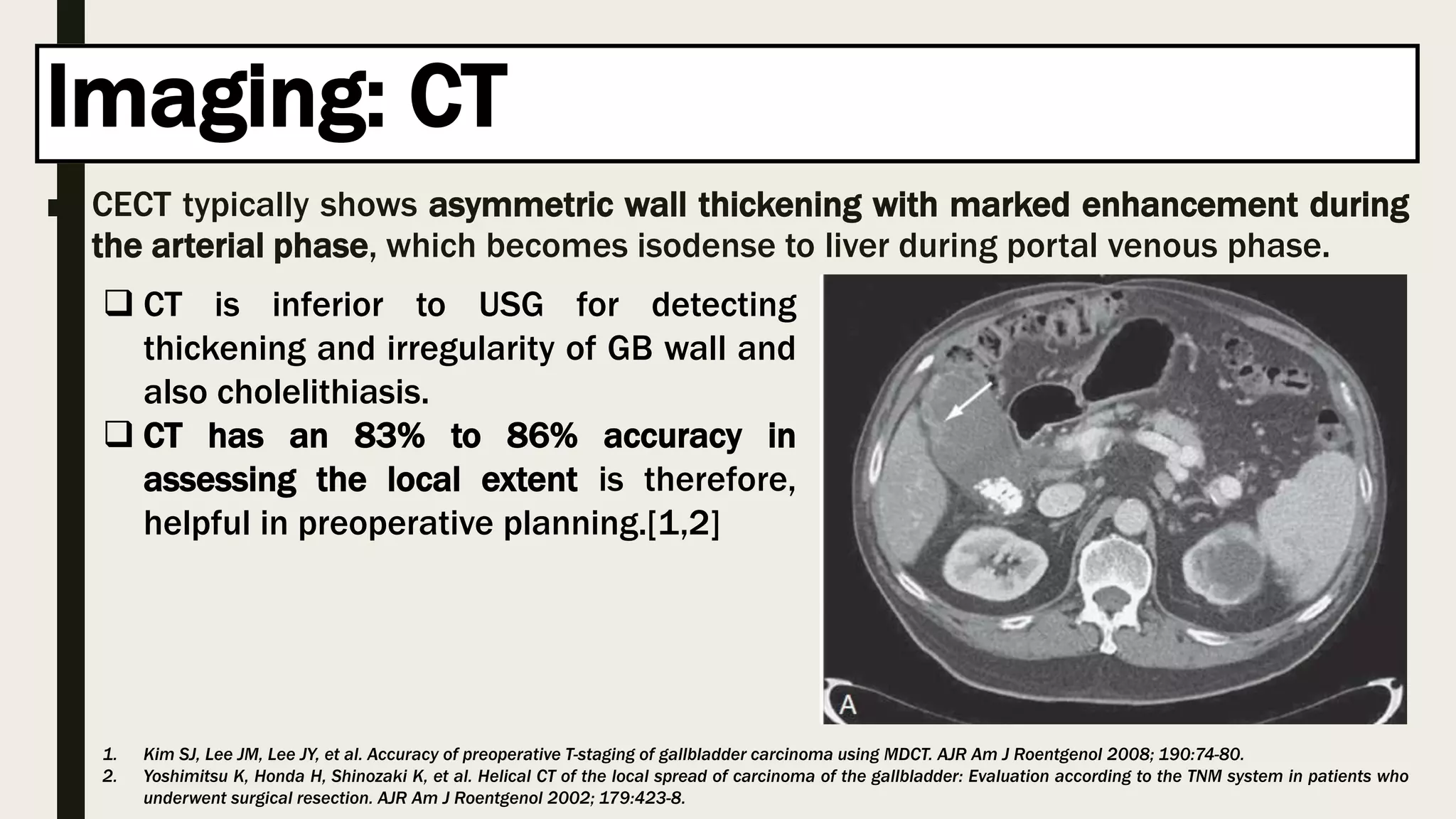 Tumors of gallbladder | PPTX