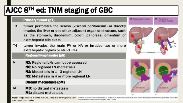 Tumors of gallbladder