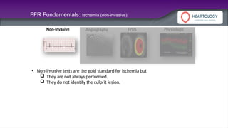CORONARY ANGIPGRAPHY AND FFR REVIEW.pptx