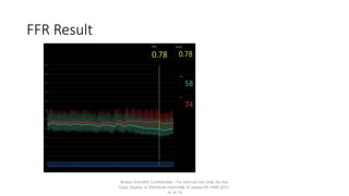 CORONARY ANGIPGRAPHY AND FFR REVIEW.pptx