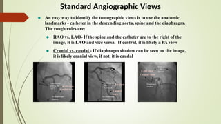 CAG interpretation Dr Shiva CTVS JIPMER | PPTX