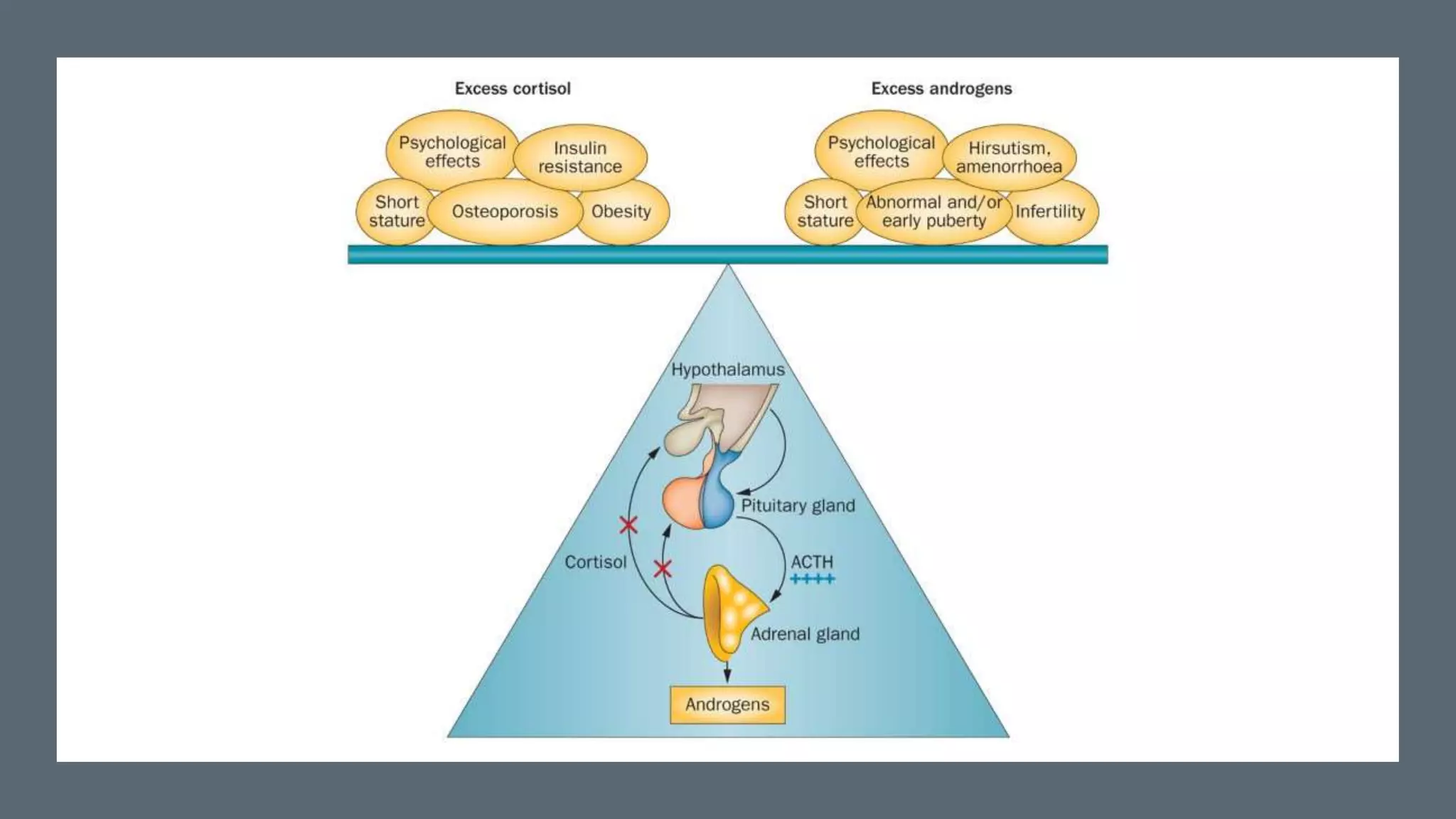 Congenital Adrenal Hyperplasia (CAH) | PPTX