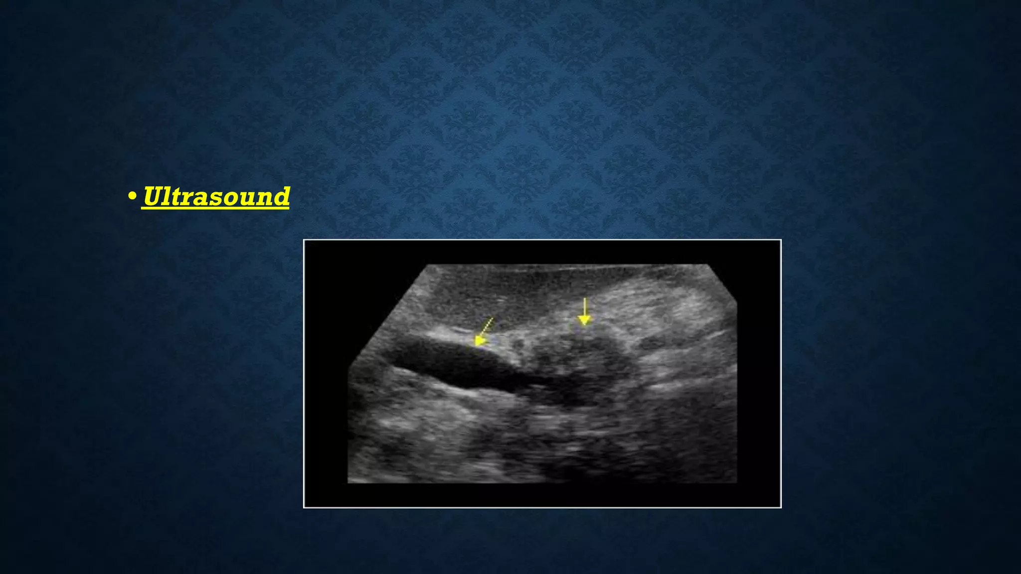 Pancreas Ca | PDF