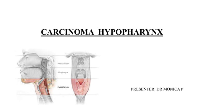 CA HYPOPHARYNX.pptx