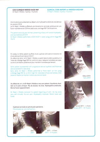 Caja cervical rsf | PDF