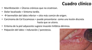 Ca labio lengua mucosa bucal y encia | PPTX