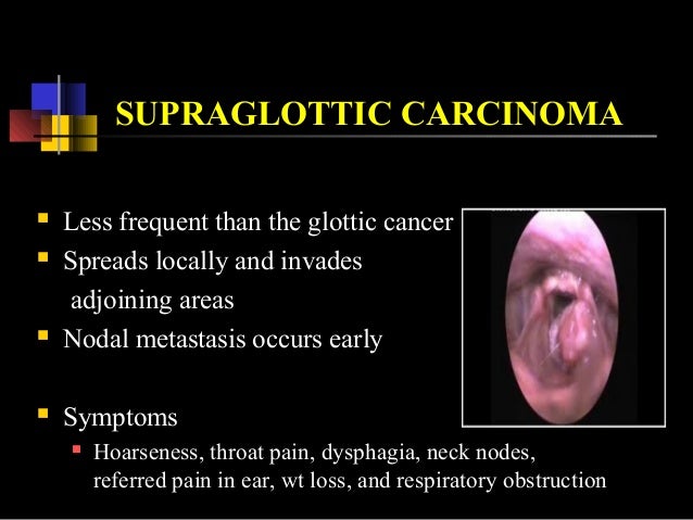 Carcinoma larynx ppt