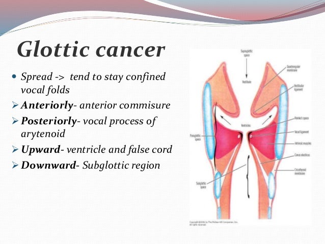 Management of Ca larynx