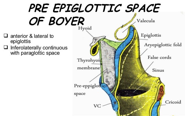 Ca larynx - etio & types