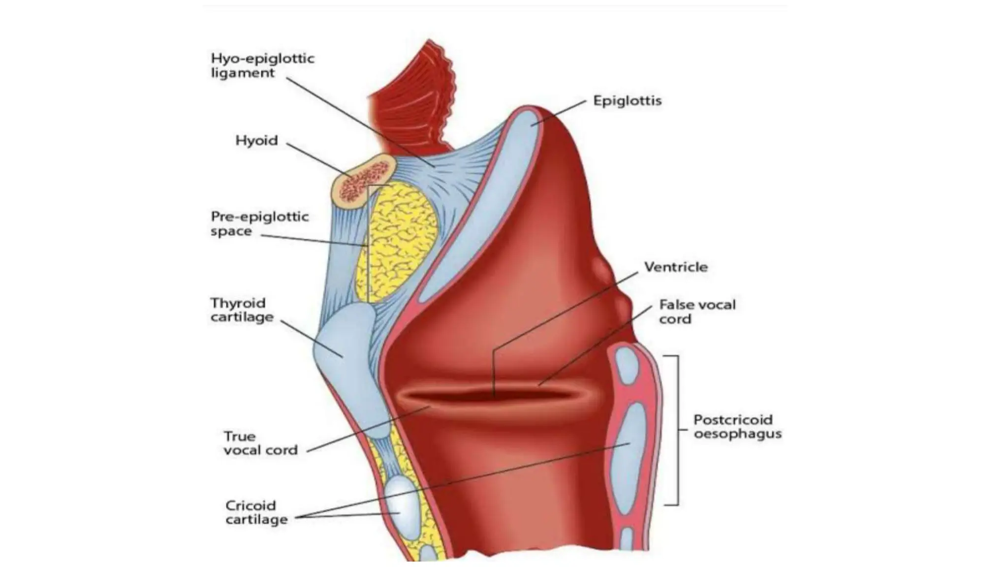 ca larynx continue (1) vrgrgefwdvferfq.pptx | Thyroid Disorders | Endocrine and Metabolic Diseases